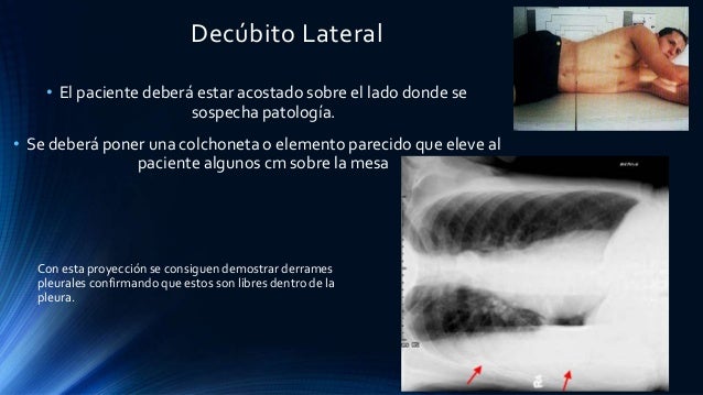 Anatomía y radiología torácica