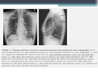 Anatomc3ada hiliar-pulmonar | PPT
