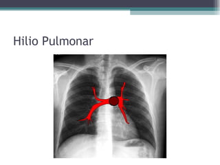 Anatomc3ada hiliar-pulmonar | PPT