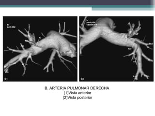 Anatomc3ada hiliar-pulmonar | PPT
