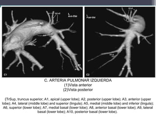 Anatomc3ada hiliar-pulmonar | PPT