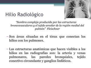 Anatomc3ada hiliar-pulmonar | PPT