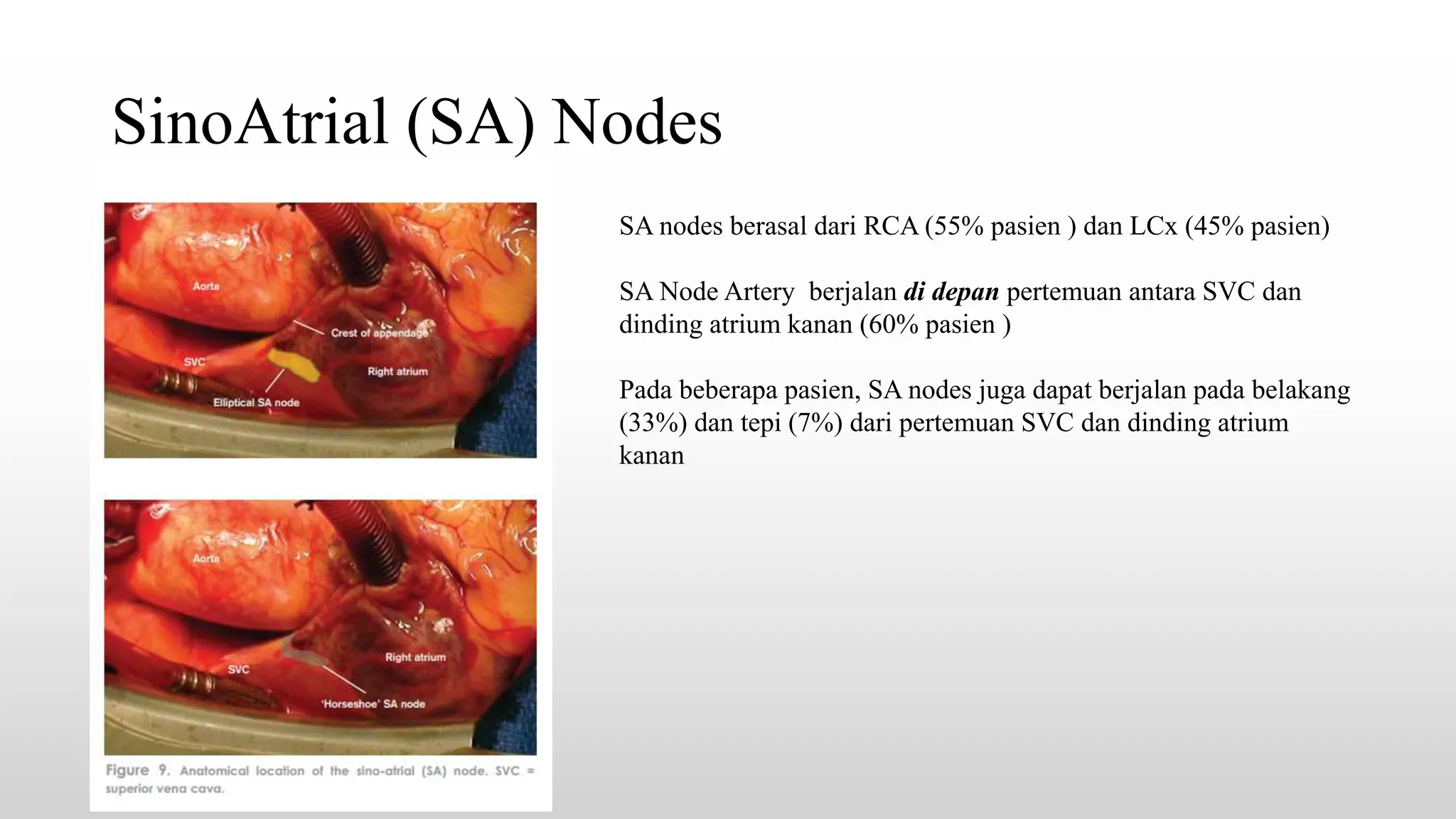 Anatomiof coronary artery and vein .pptx