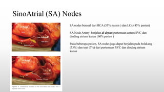 Anatomiof coronary artery and vein .pptx