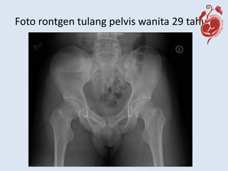 anatomi-dinding-pelvis_compress pada manusia.pdf