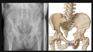 Anatomia | PPT
