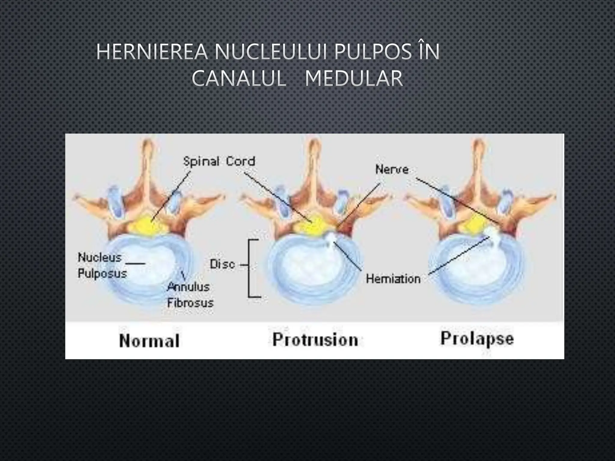 ANATOMIA-COLOANEI-VERTEBRALE........pptx