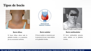 Anatomia-de-la-glandula-tiroides by katherine.pptx