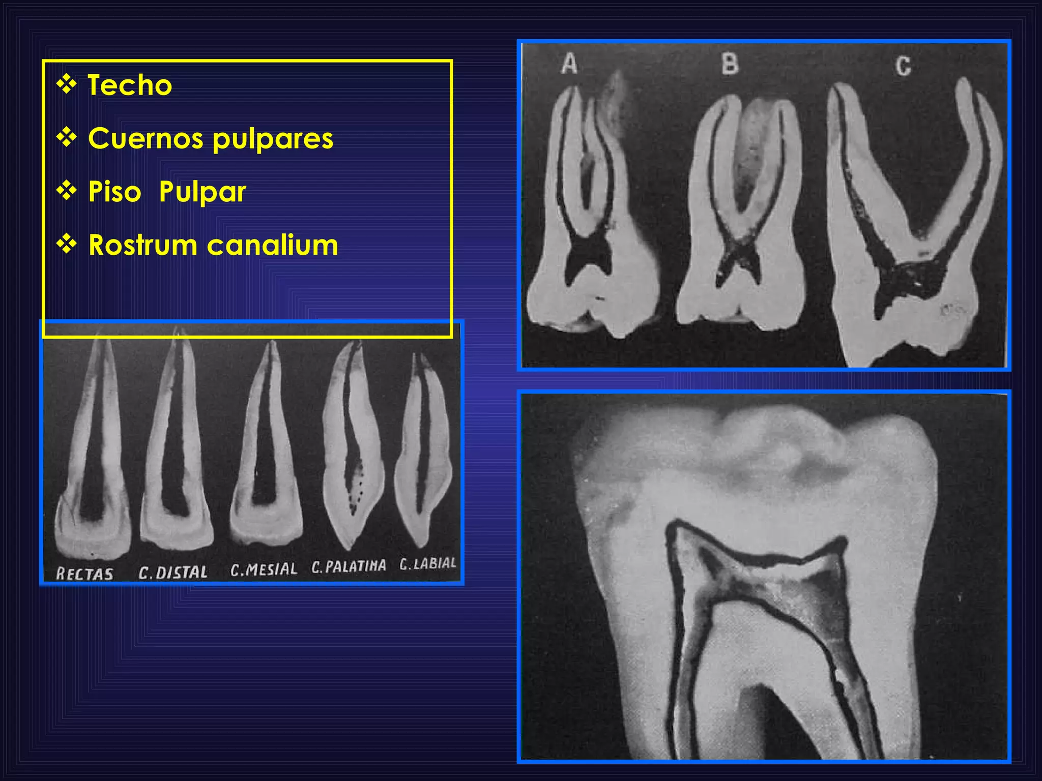 Anatomia De Los Conducto Radiculares F | PPT | Dental Health | Diseases ...