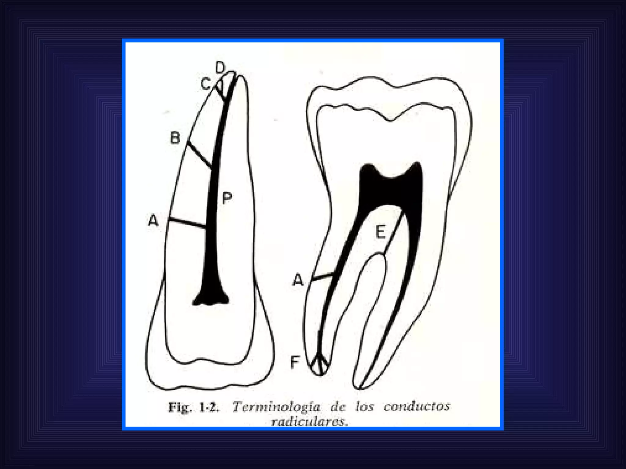 Anatomia De Los Conducto Radiculares F | PPT | Dental Health | Diseases ...