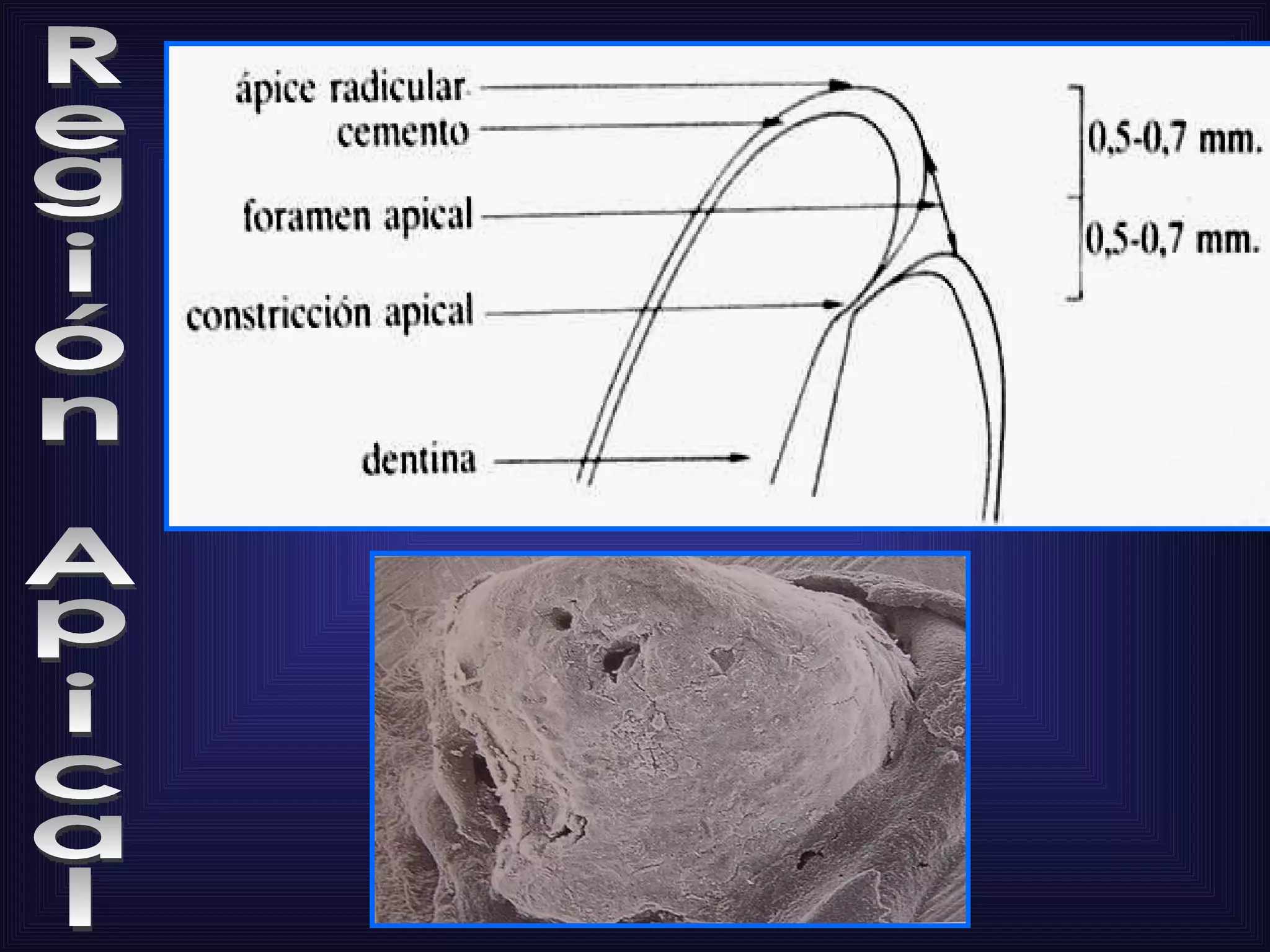 Anatomia De Los Conducto Radiculares F | PPT | Dental Health | Diseases ...