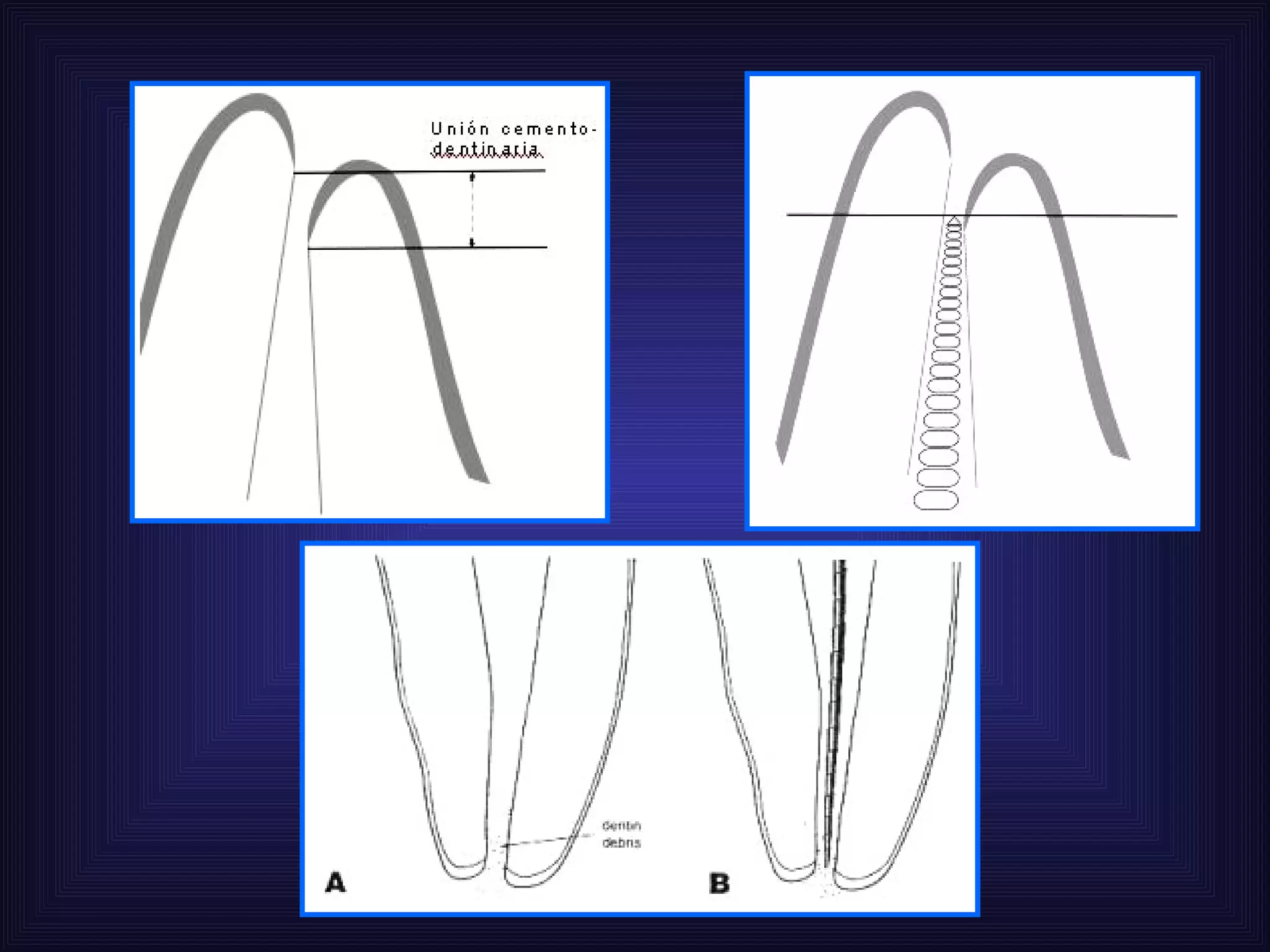 Anatomia De Los Conducto Radiculares F | PPT | Dental Health | Diseases ...