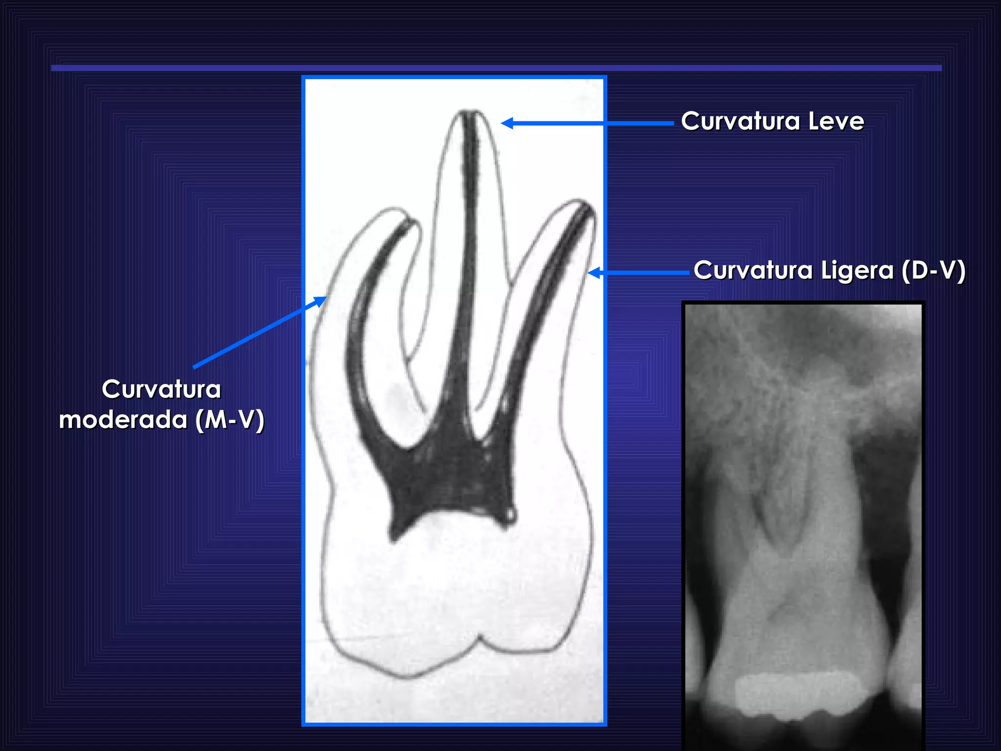 Anatomia De Los Conducto Radiculares F | PPT | Dental Health | Diseases ...