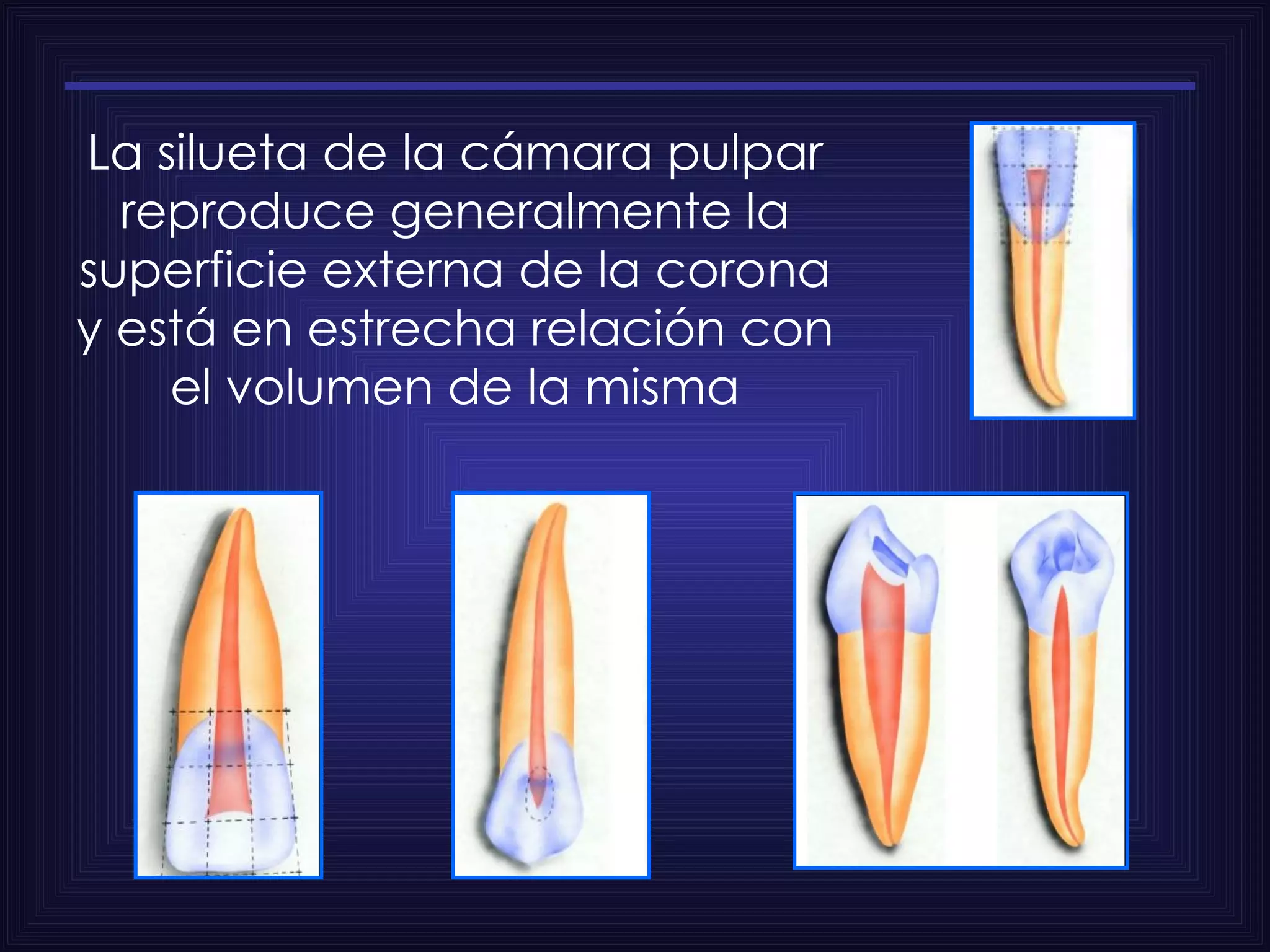 Anatomia De Los Conducto Radiculares F | PPT | Dental Health | Diseases ...