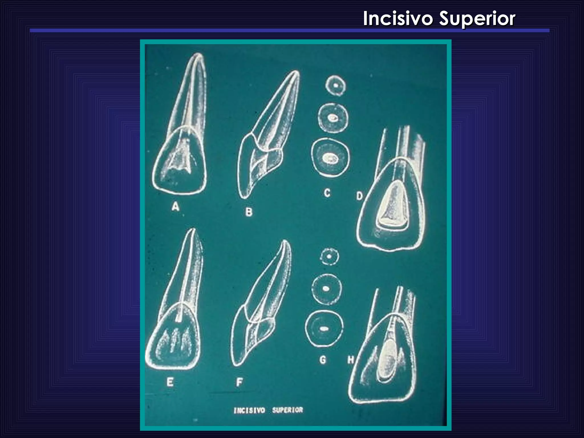 Anatomia De Los Conducto Radiculares F | PPT | Dental Health | Diseases ...