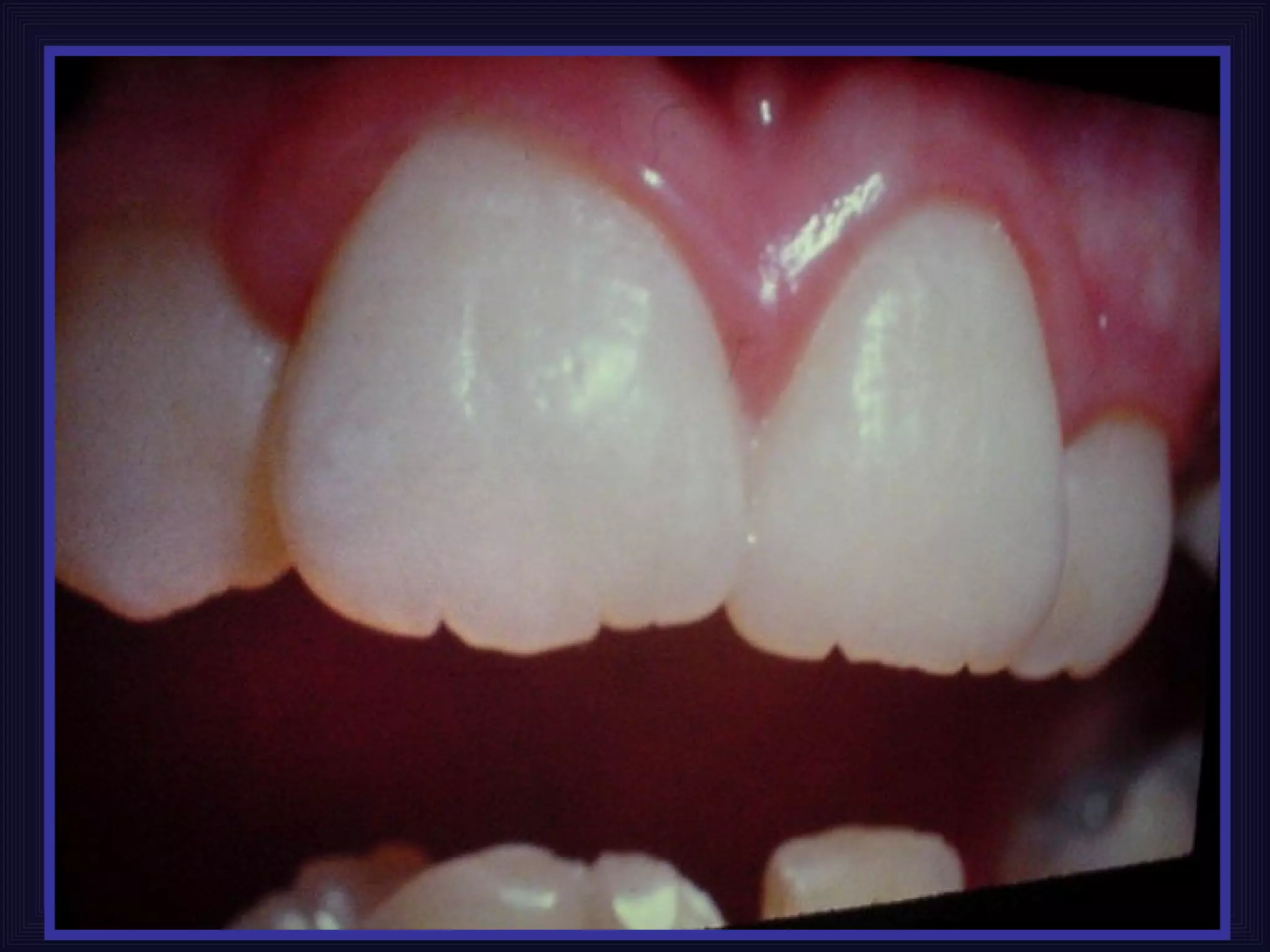 Anatomia De Los Conducto Radiculares F | PPT | Dental Health | Diseases ...