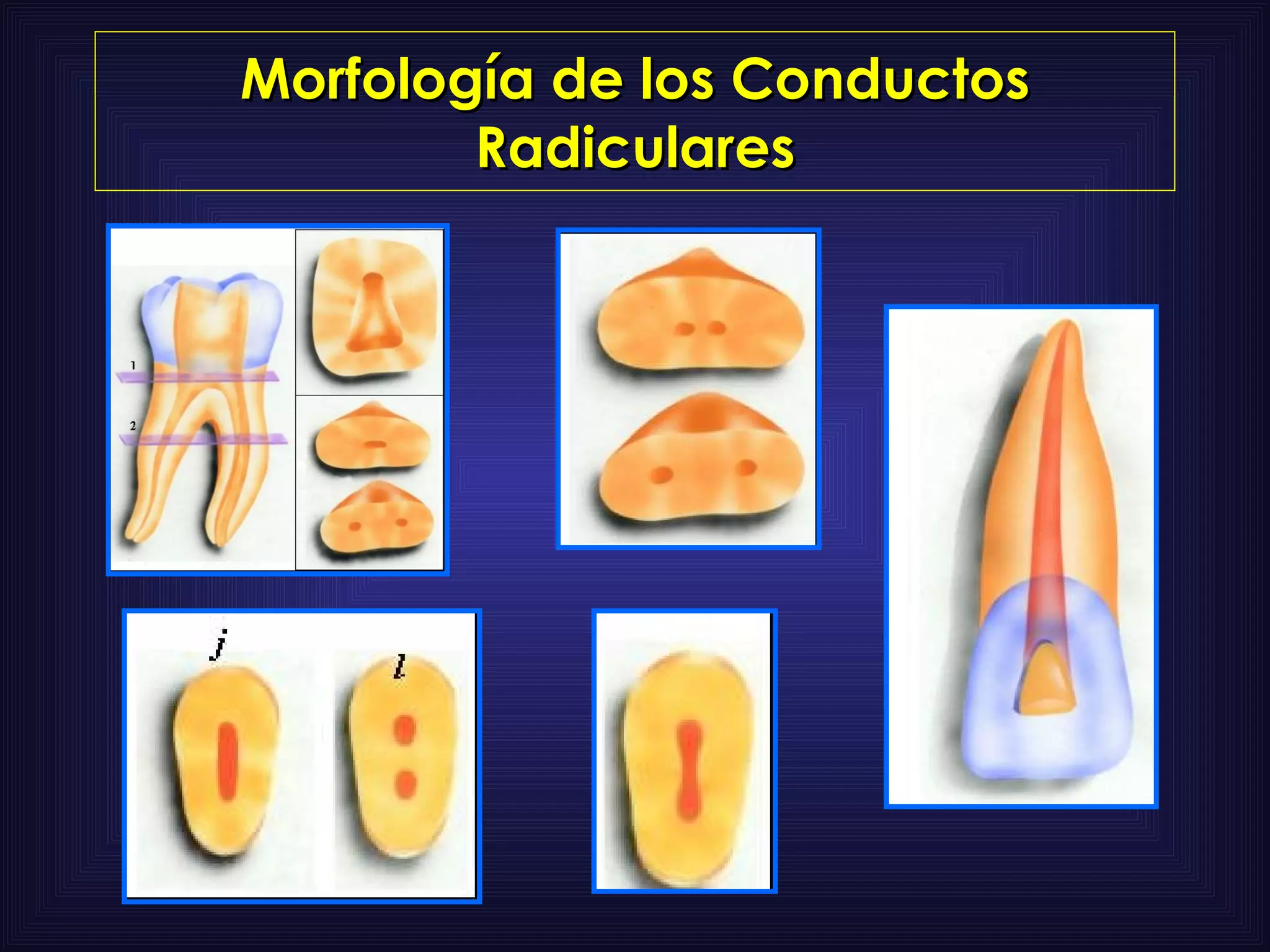 Anatomia De Los Conducto Radiculares F