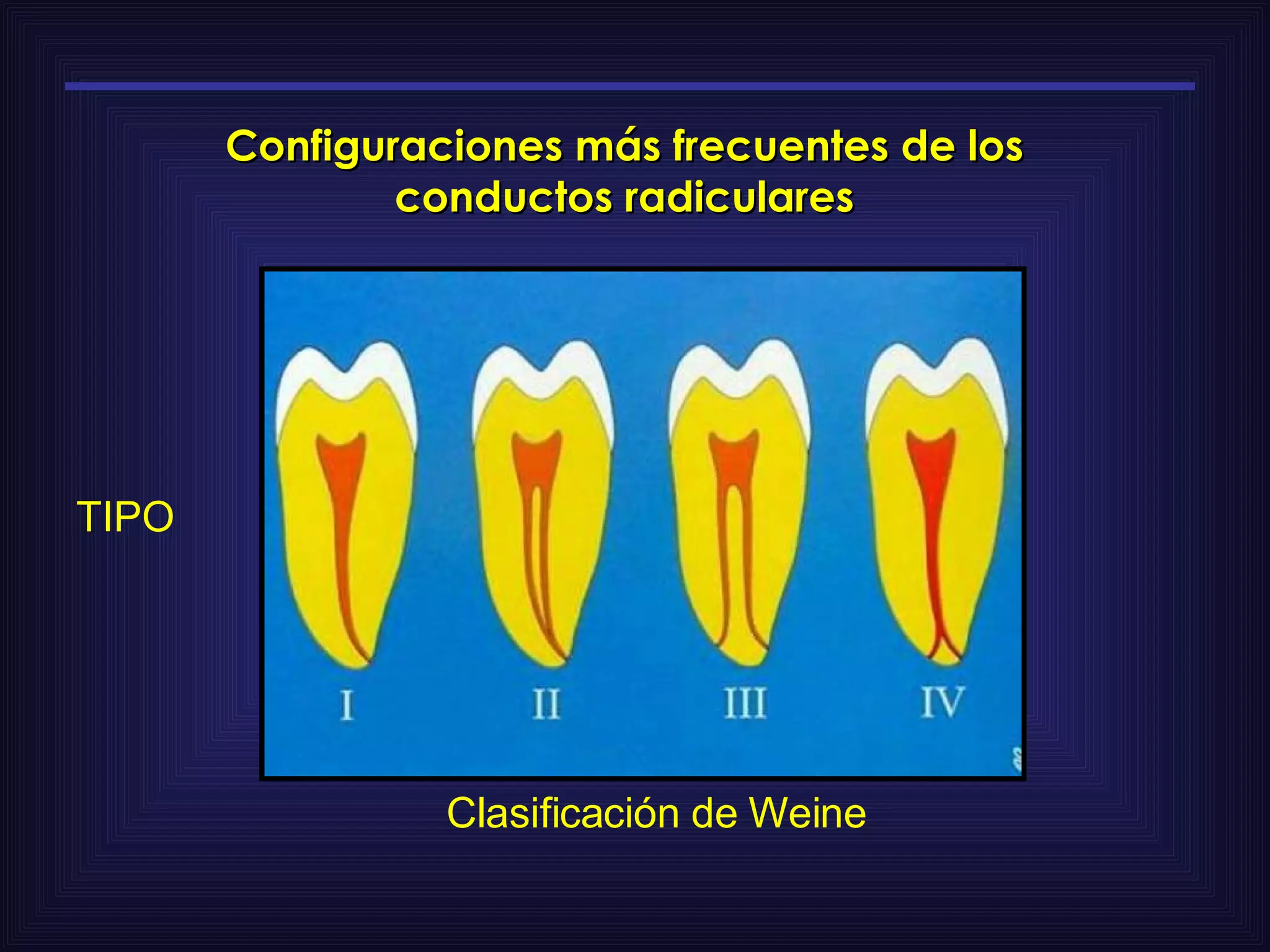 Anatomia De Los Conducto Radiculares F