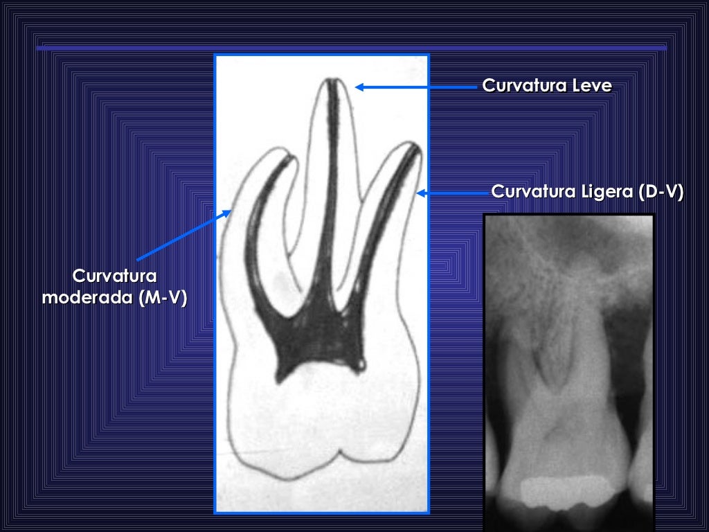 Anatomia De Los Conducto Radiculares F