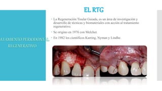 Enfermedad periodontal | PPTX
