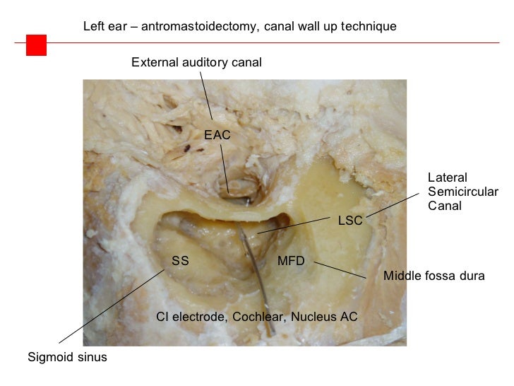 Clinical anatomy of the middle ear
