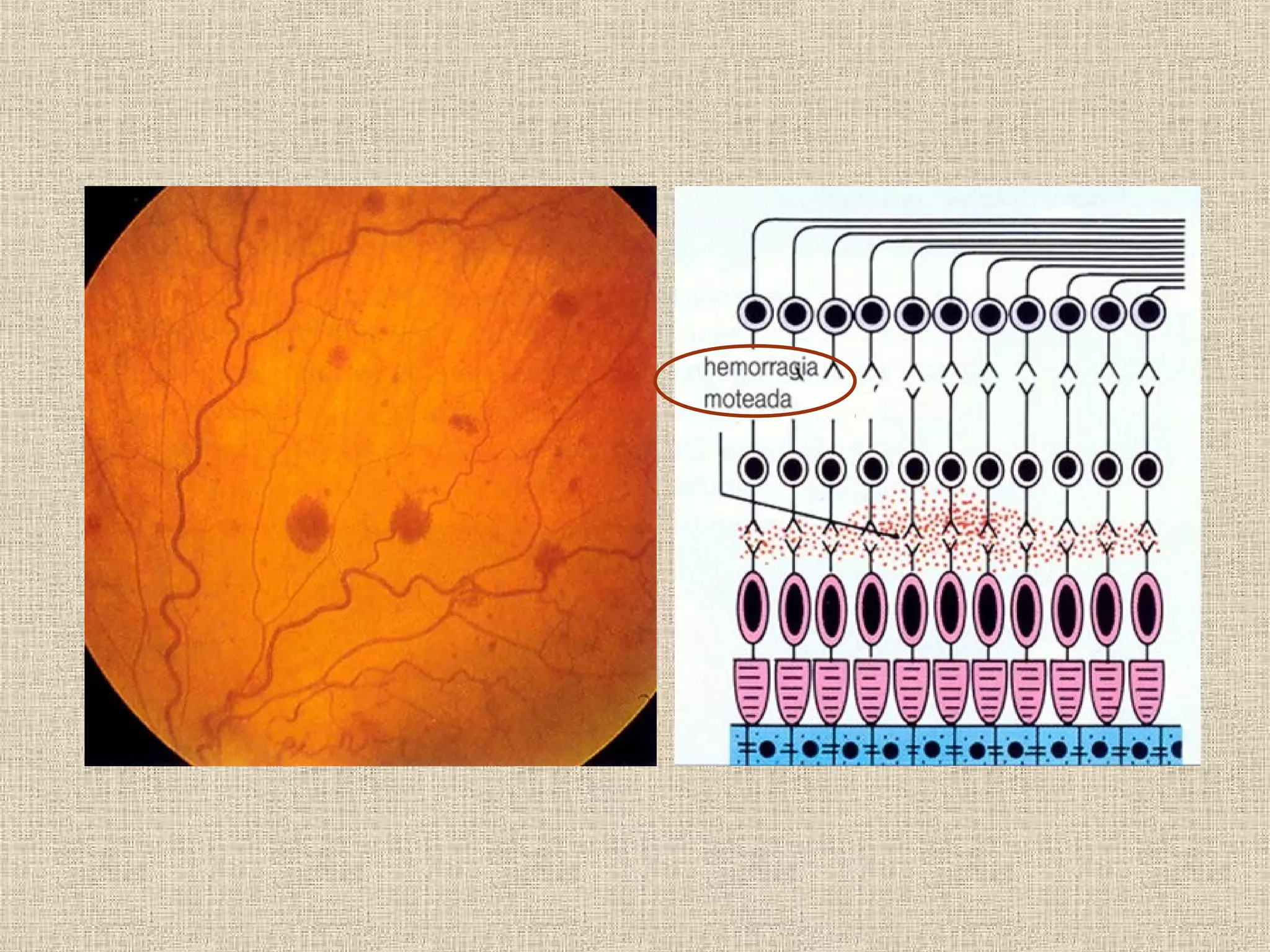 Anatomia retina | PPT | Eye and Vision Conditions | Diseases and Conditions