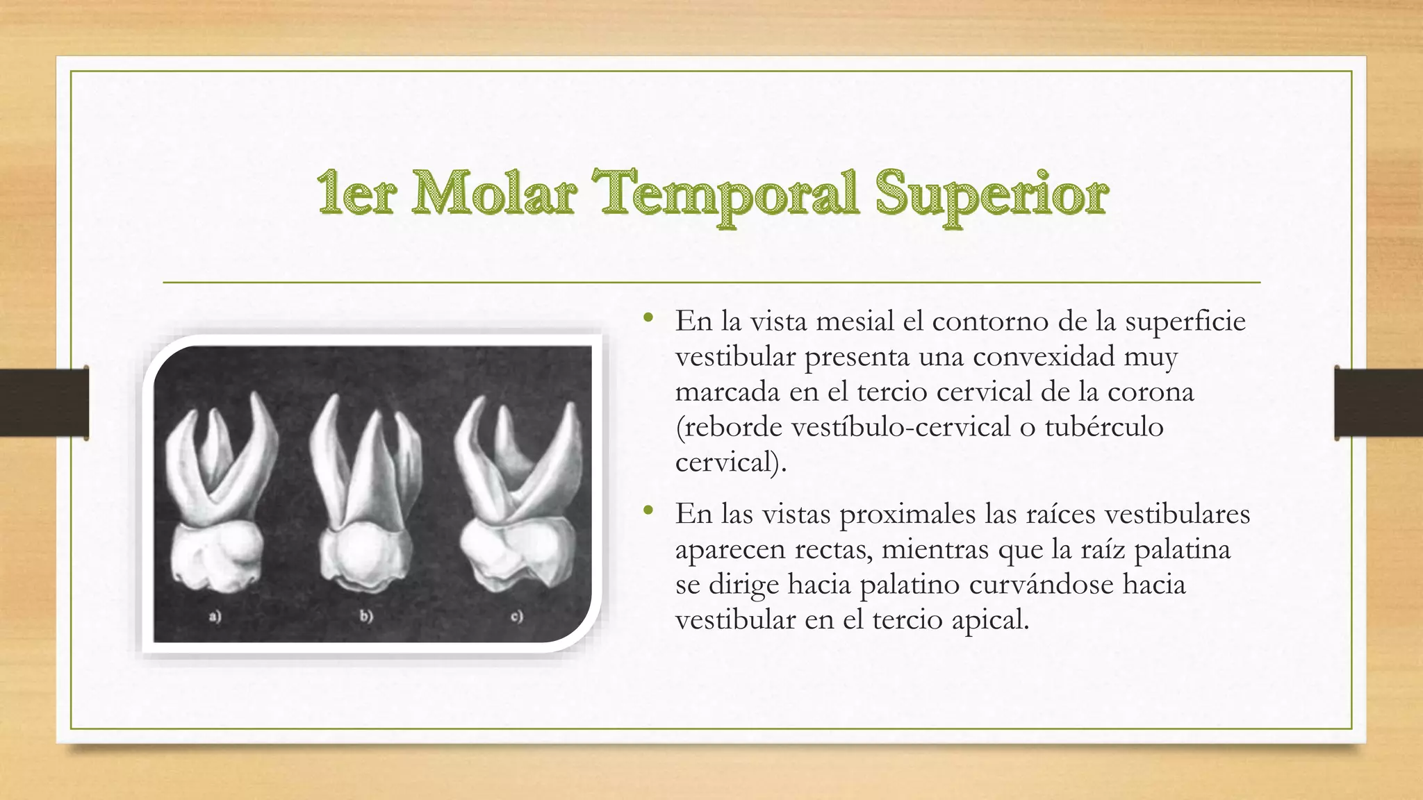 Anatomia 1er molar temporal | PPTX