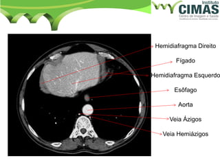 aula completa sobre Anatomia do abdomem.pdf