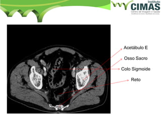 aula completa sobre Anatomia do abdomem.pdf