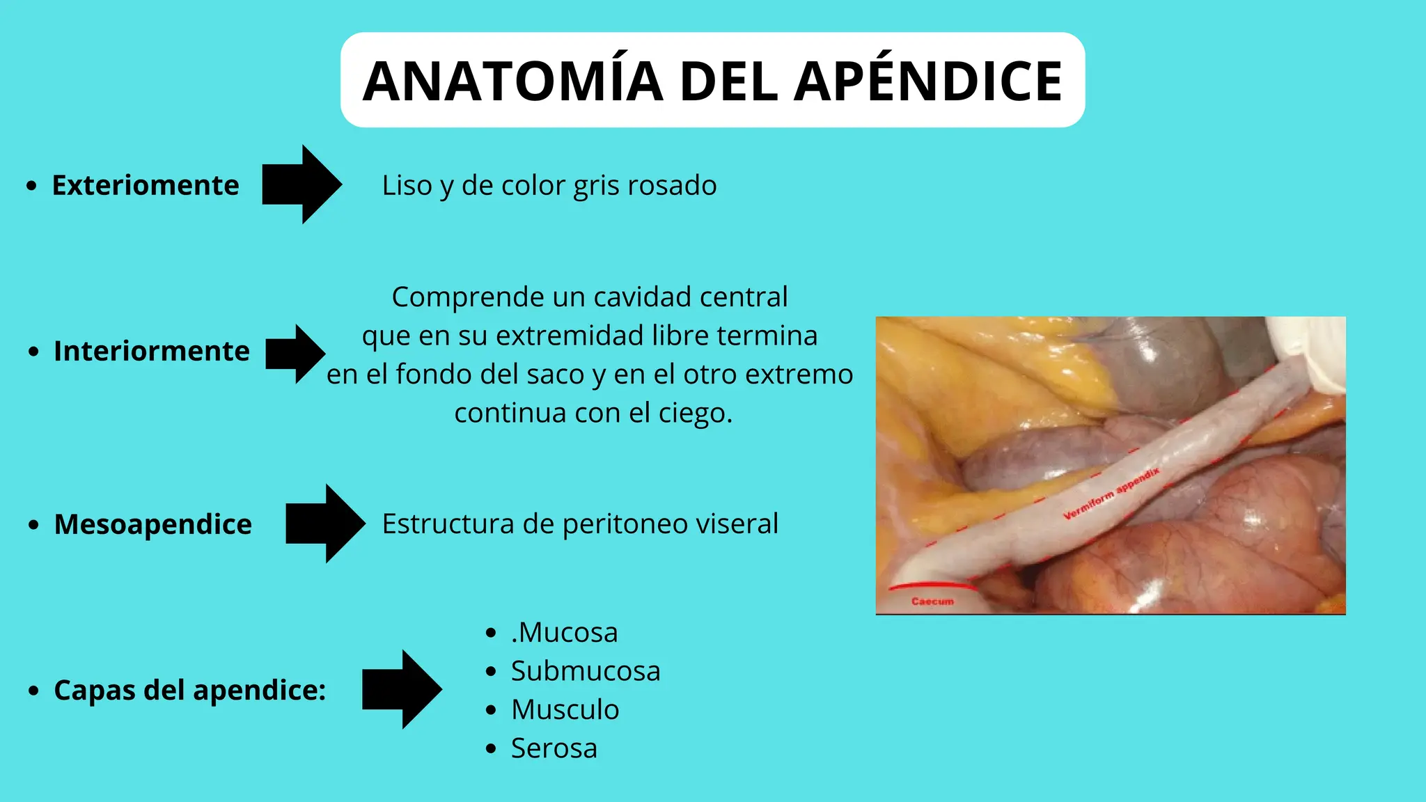 anatomia abdominal apendicitis aguda.pdf