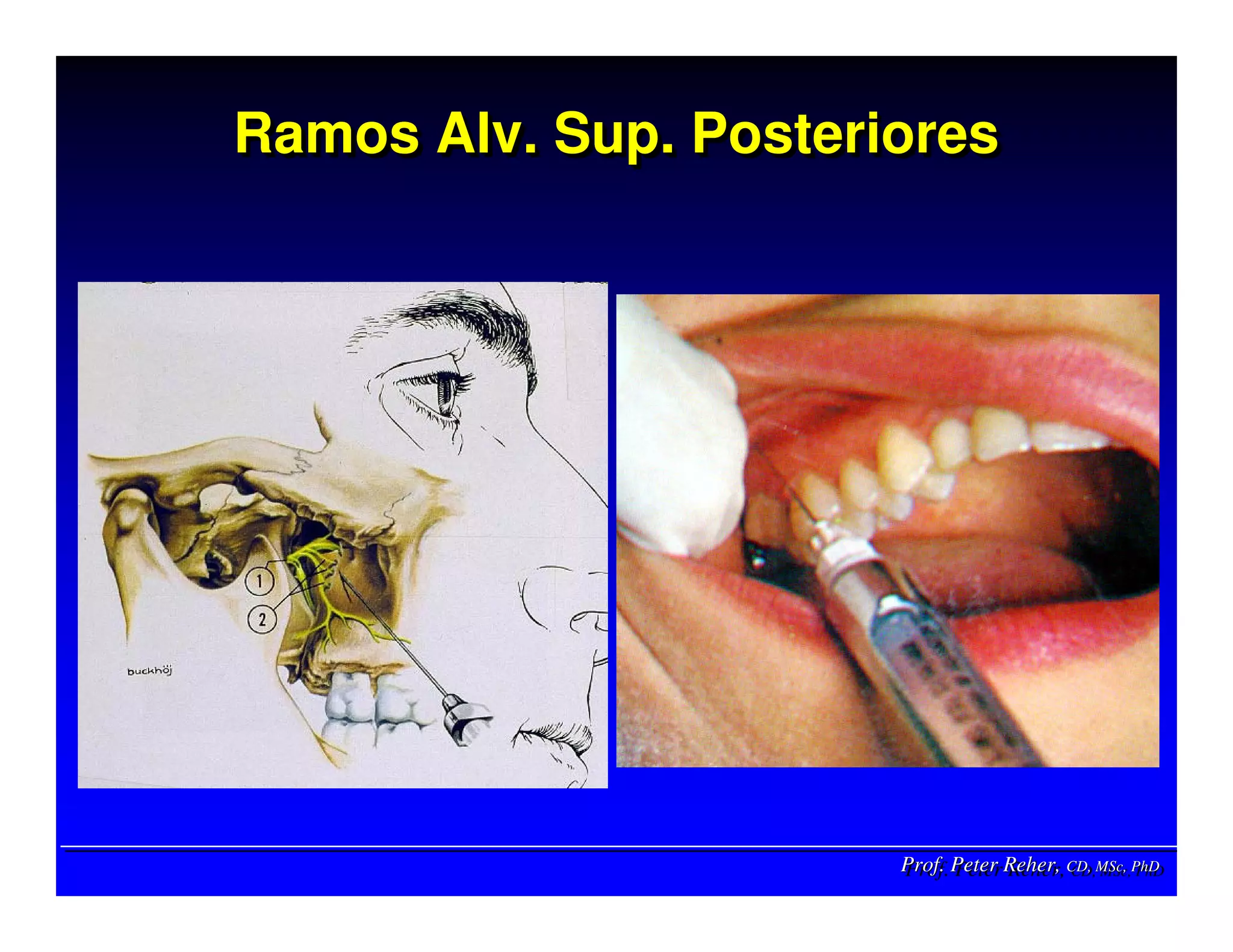 Anatomia anestesica | PDF