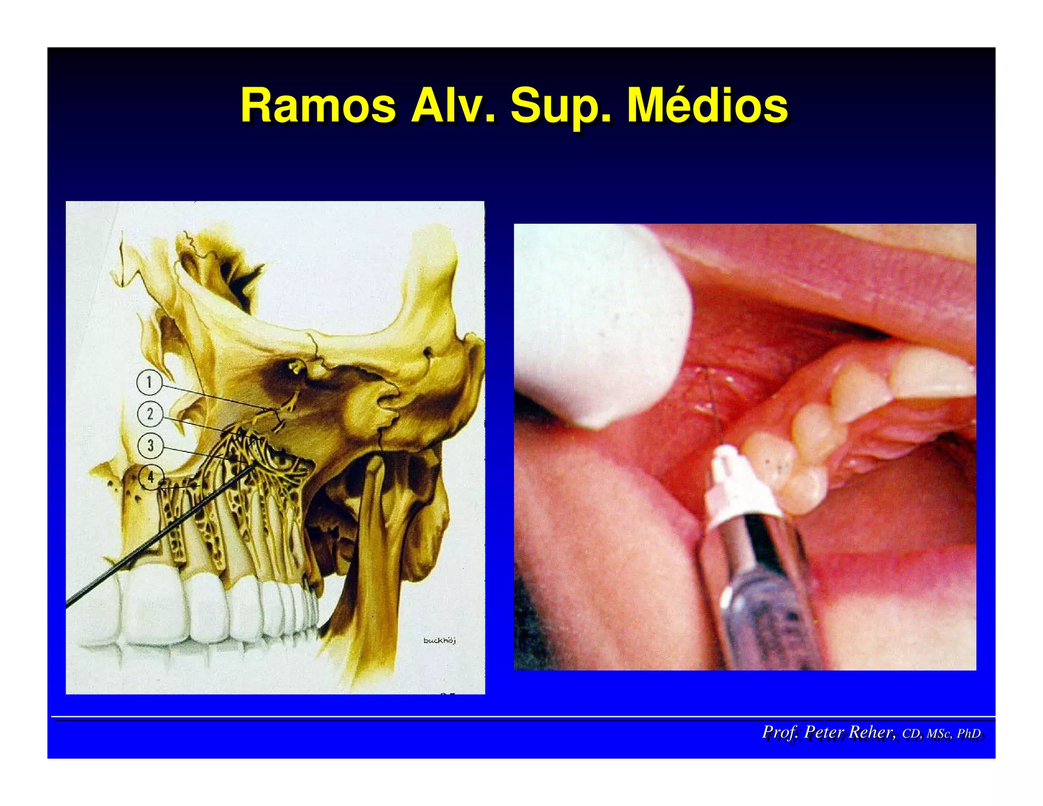 Anatomia anestesica | PDF