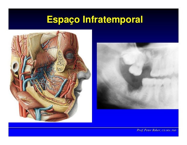 Espaco Infratemporal