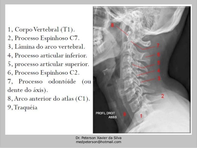 Anatomia Aplicada da Coluna Cervical