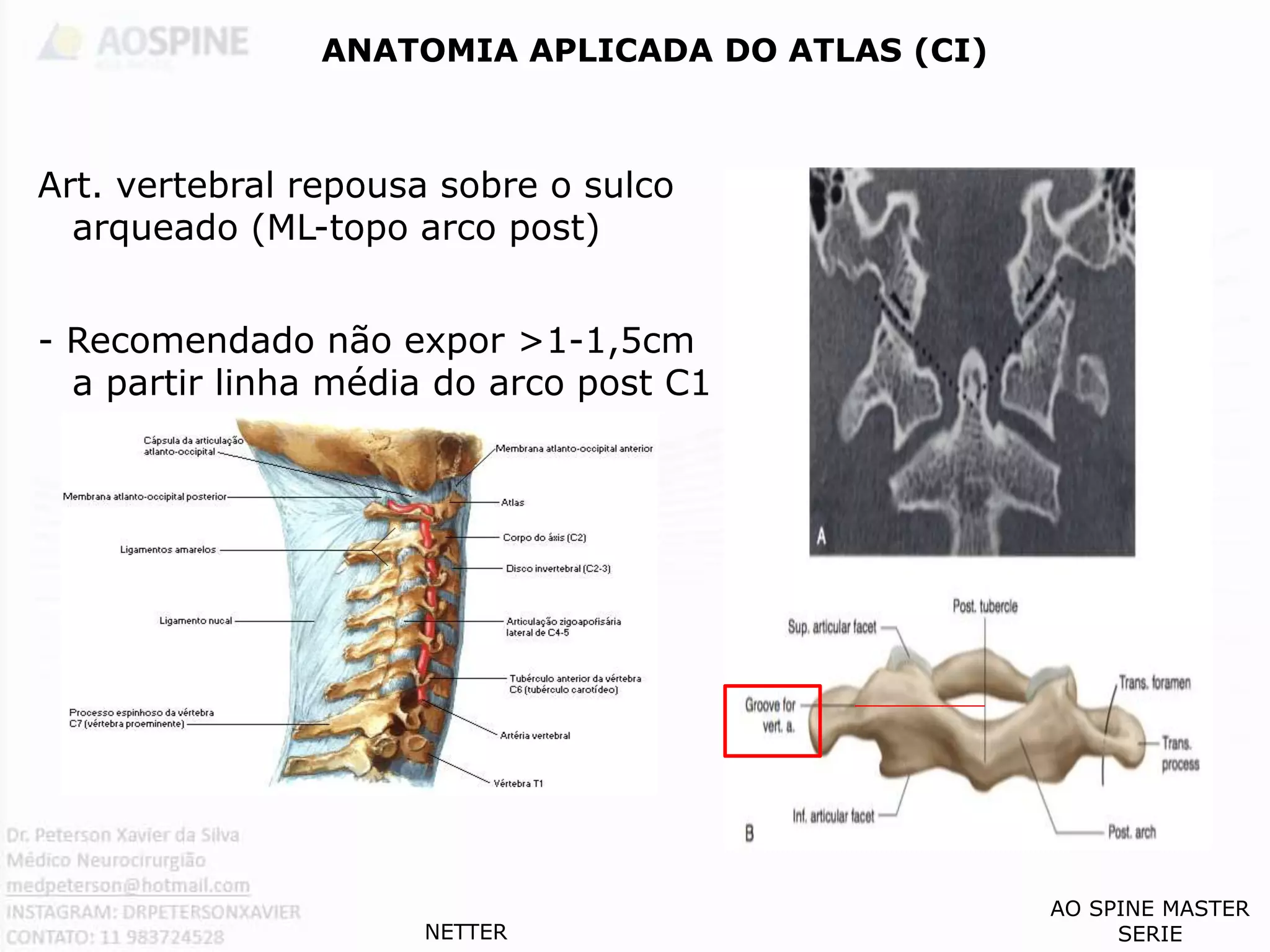 Anatomia Aplicada da Coluna Cervical | PPT