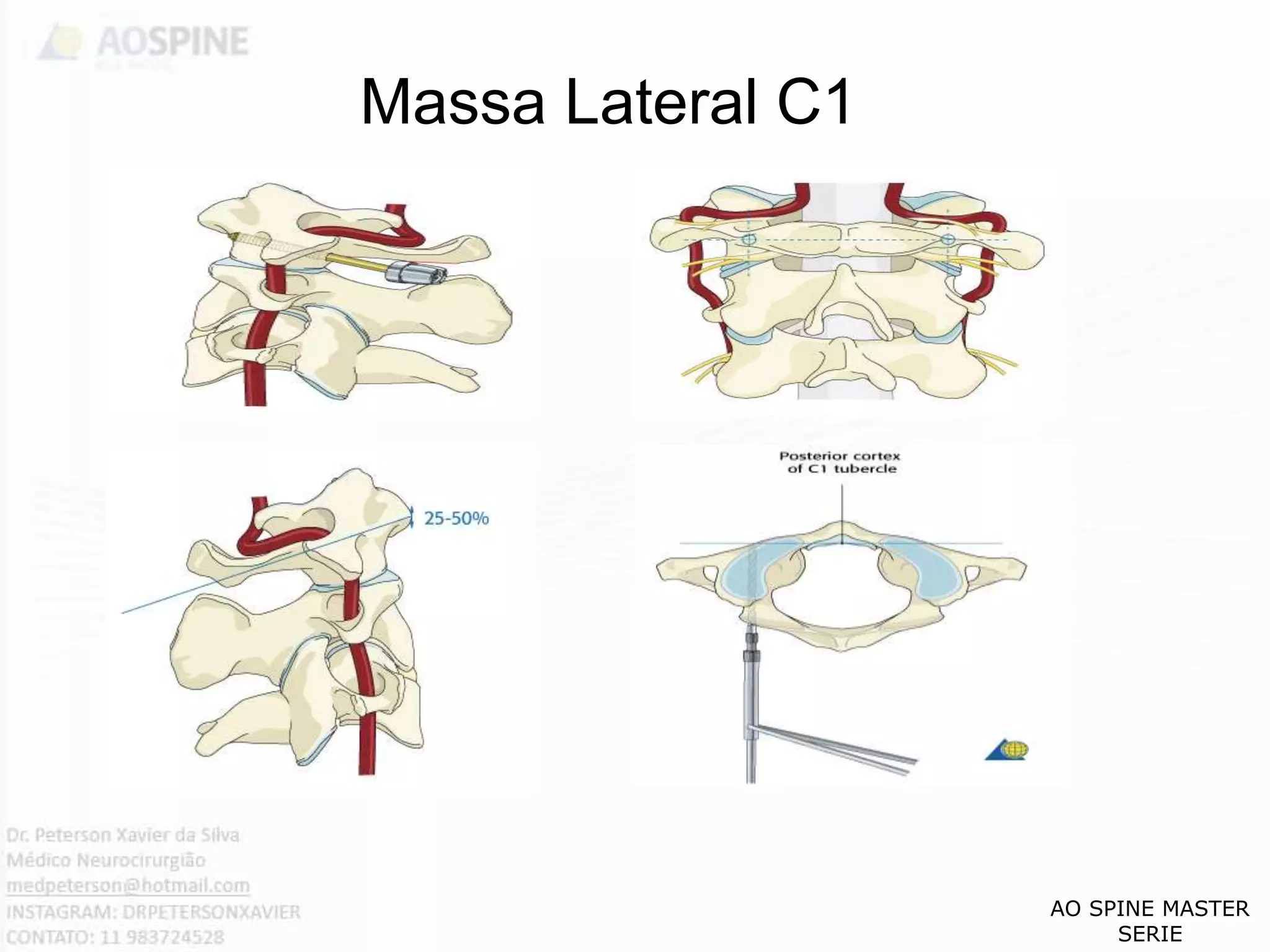Anatomia Aplicada da Coluna Cervical | PPT