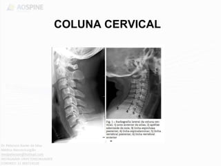 Anatomia Aplicada da Coluna Cervical | PPTX