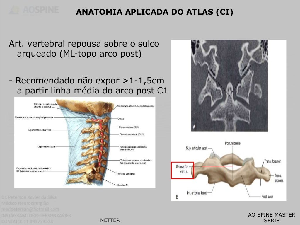 Anatomia Aplicada da Coluna Cervical