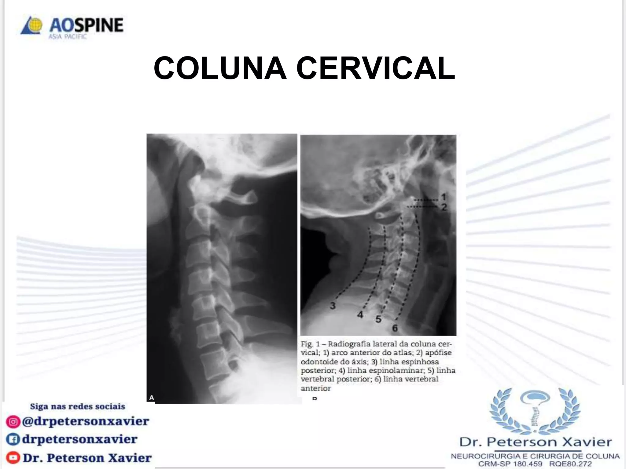 Anatomia Aplicada da Coluna Cervical | PPT