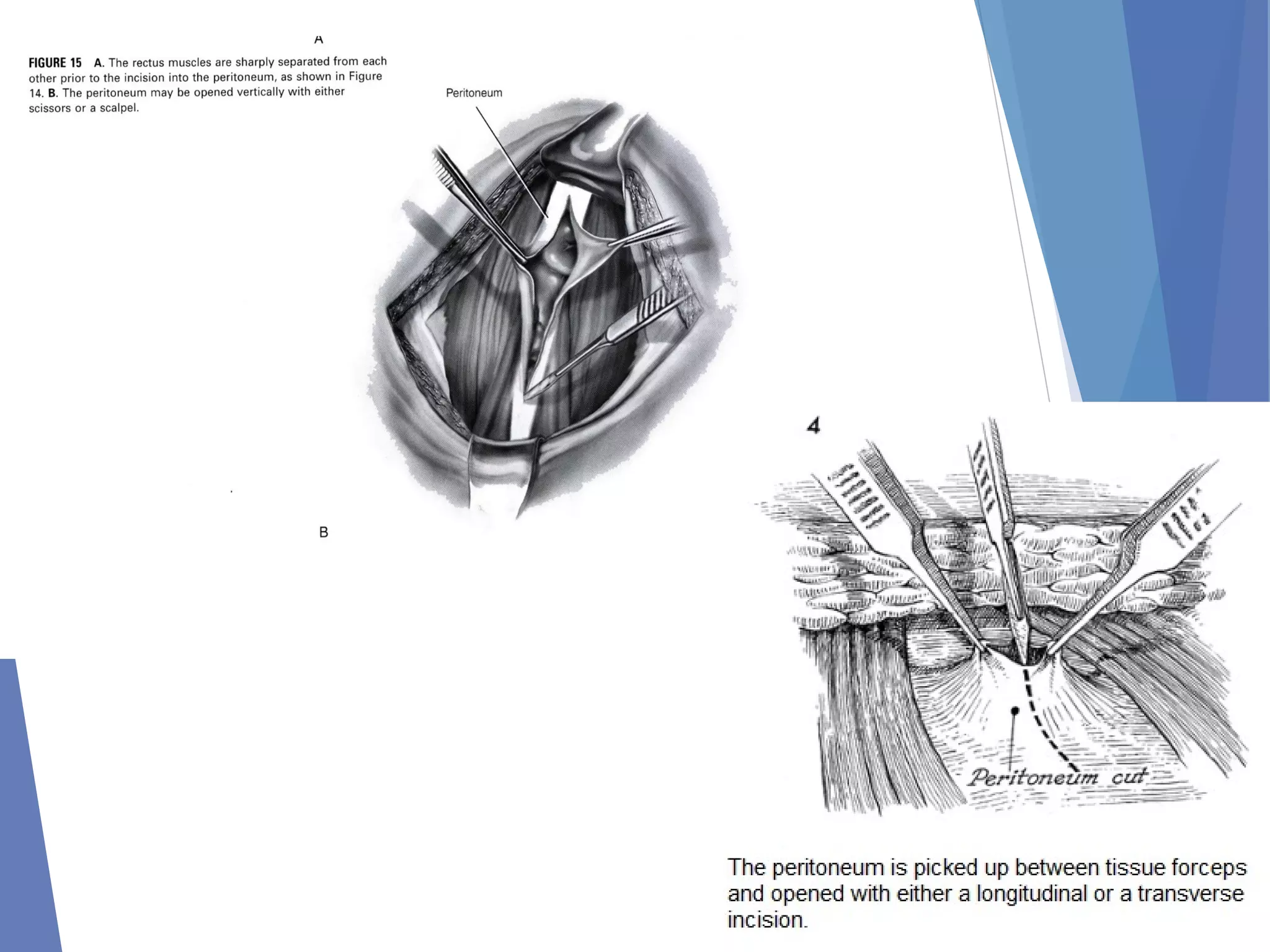 Abdominal incision and abdominal anatomy | PPT