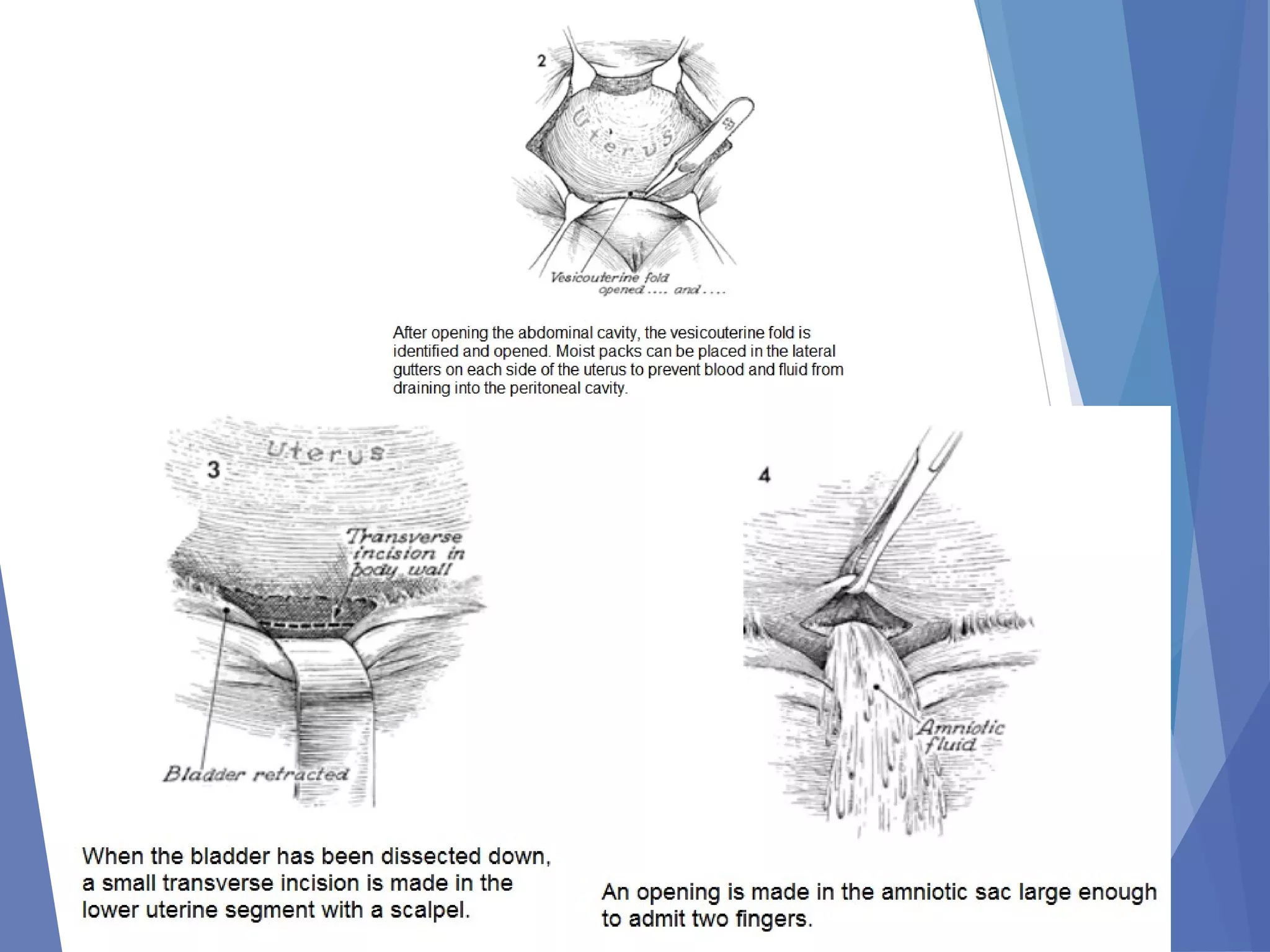 Abdominal incision and abdominal anatomy | PPT