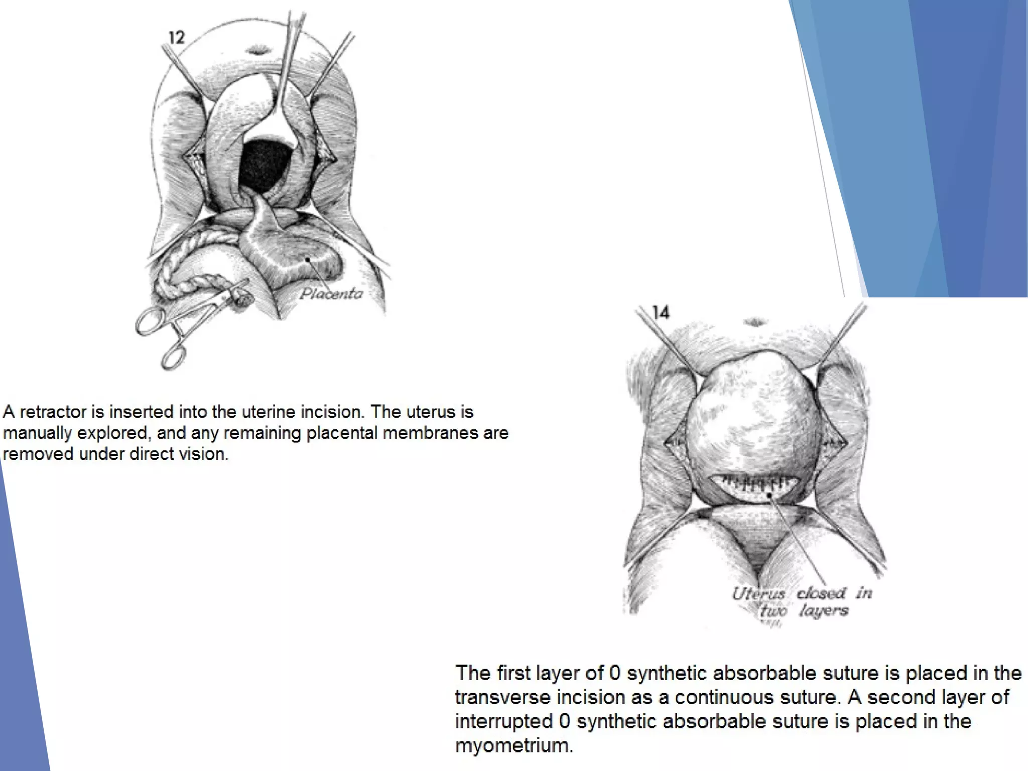 Abdominal incision and abdominal anatomy | PPT