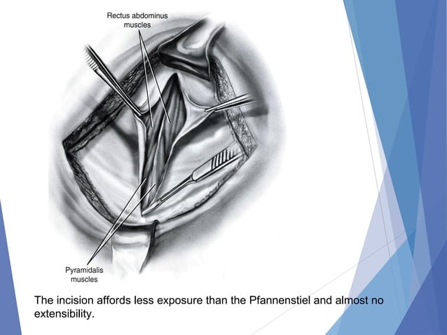 Abdominal incision and abdominal anatomy | PPT | Pregnancy ...