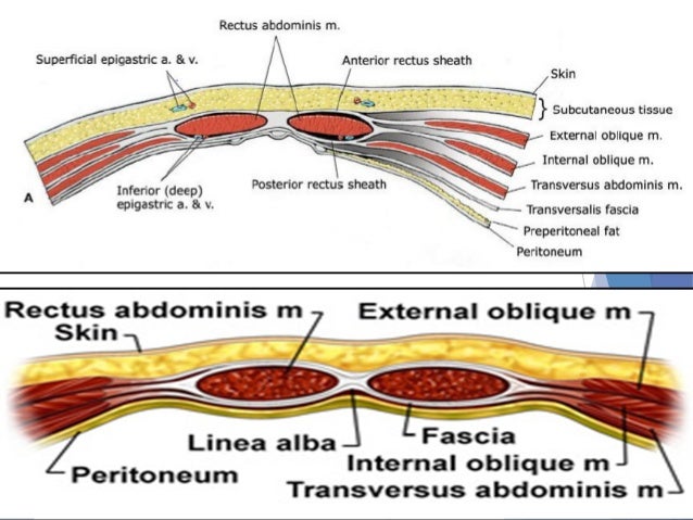 Abdominal incision and abdominal anatomy