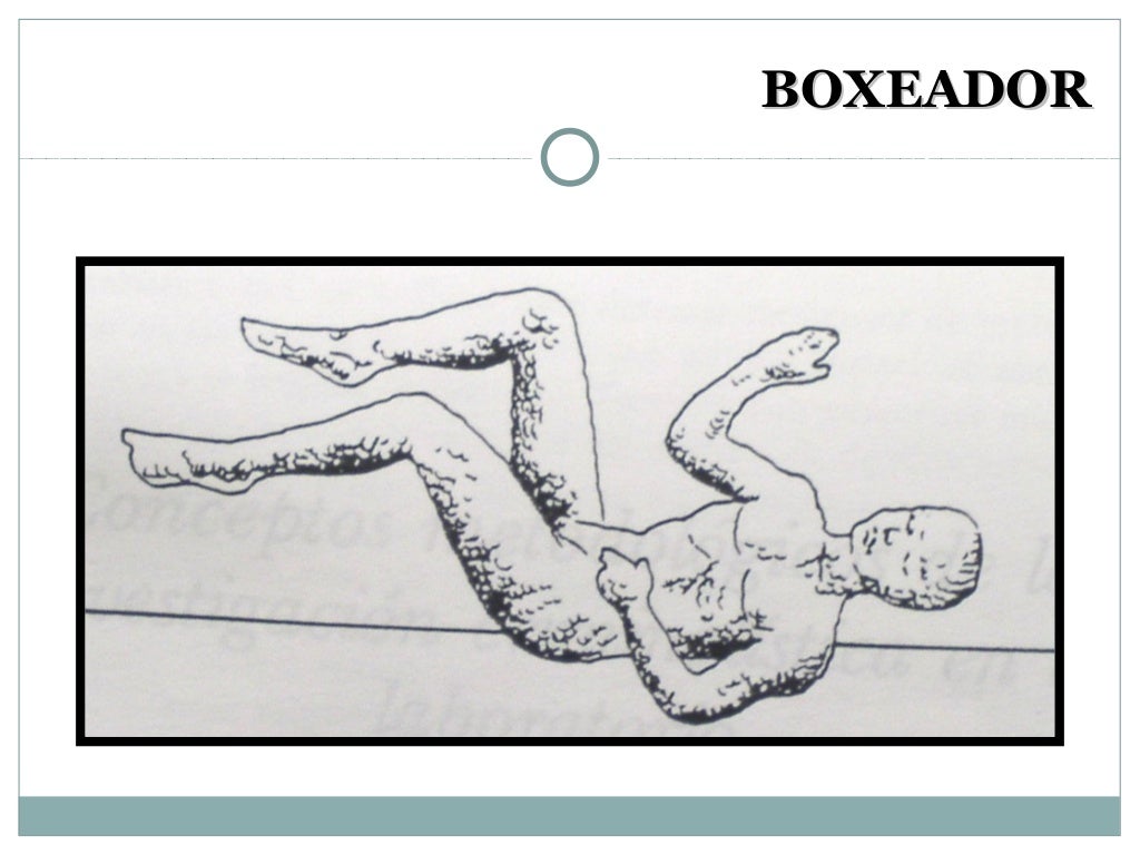 Posição Do Boxeador Cadaver - BRAINCP