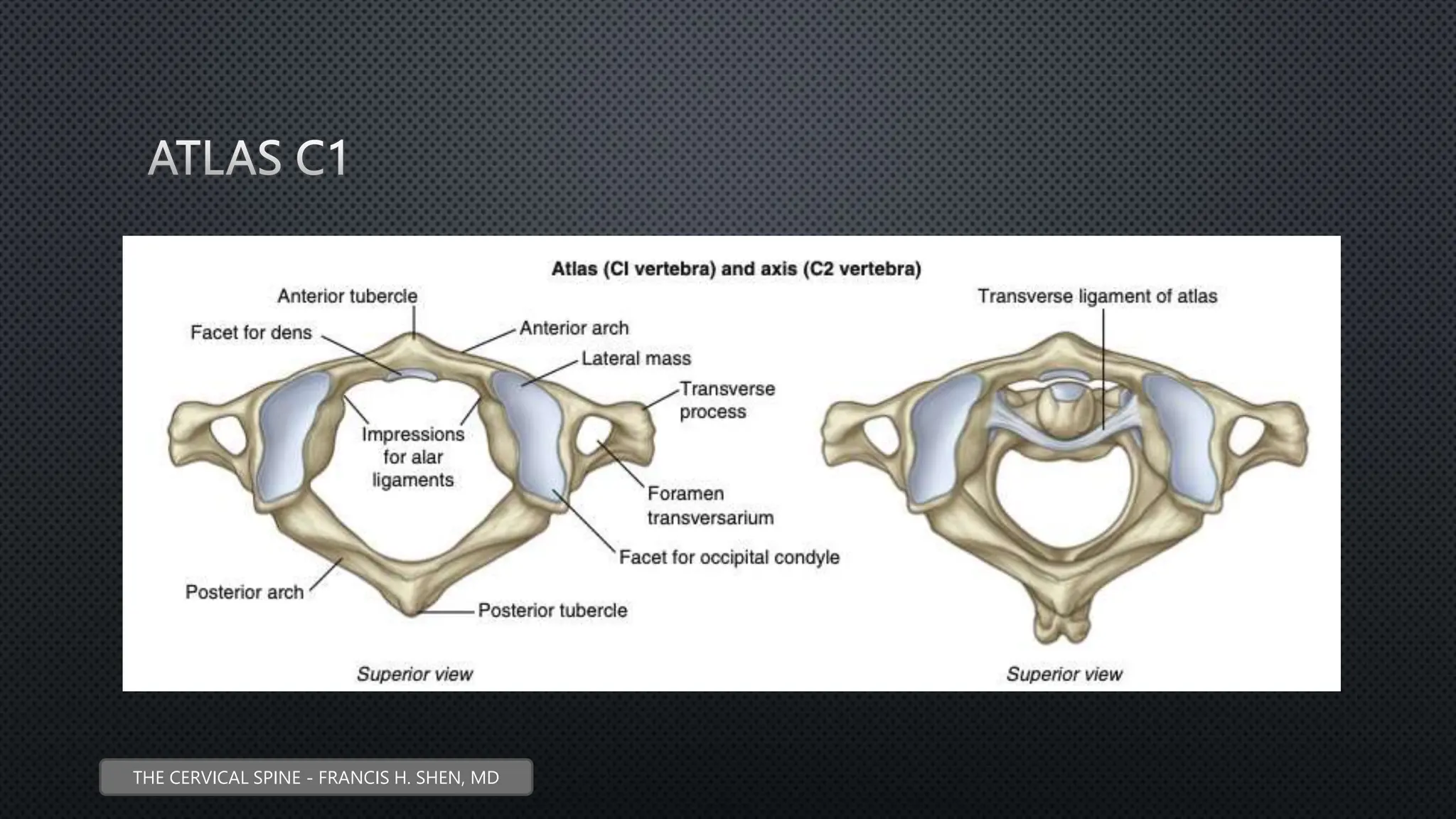 ANATOMIA C1 - C2 - LIGAMENTOS NUEROANATOMIA | PPTX | Physical Therapy ...