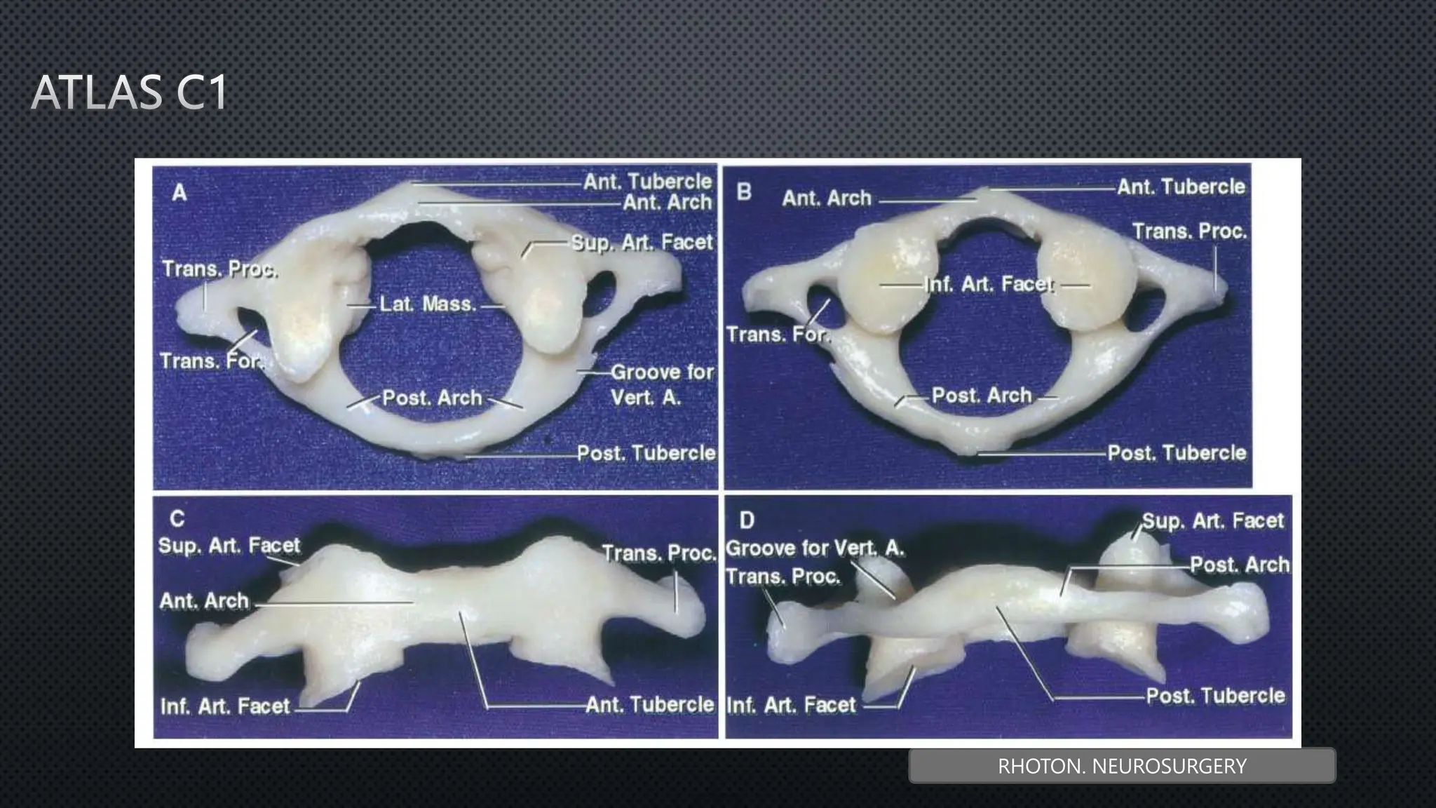 ANATOMIA C1 - C2 - LIGAMENTOS NUEROANATOMIA | PPTX