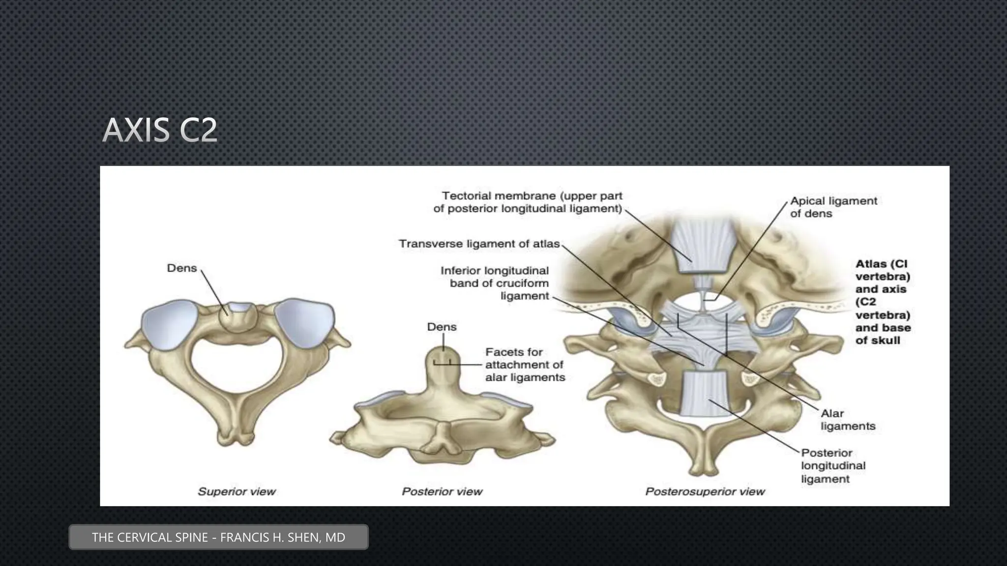 ANATOMIA C1 - C2 - LIGAMENTOS NUEROANATOMIA | PPTX
