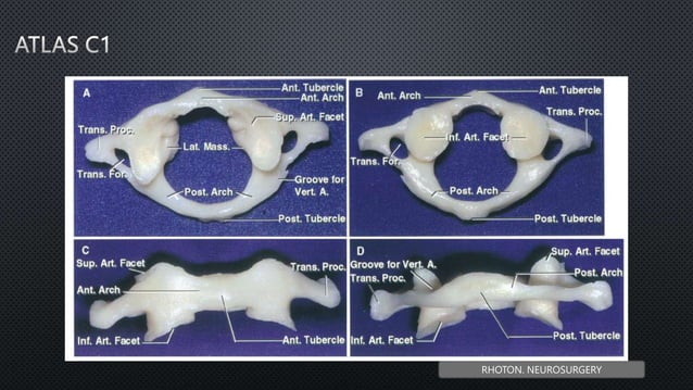 ANATOMIA C1 - C2 - LIGAMENTOS NUEROANATOMIA | PPTX | Physical Therapy ...