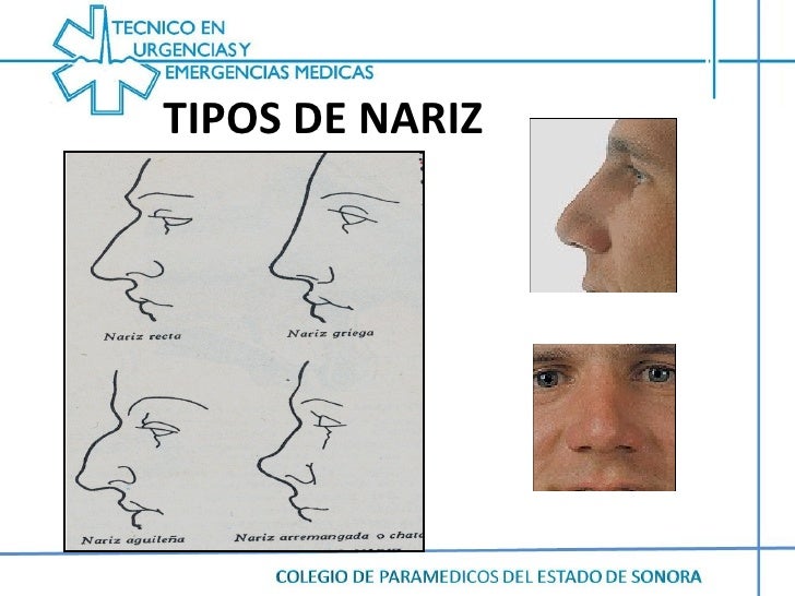 Tipos de nariz nombres - Imagui